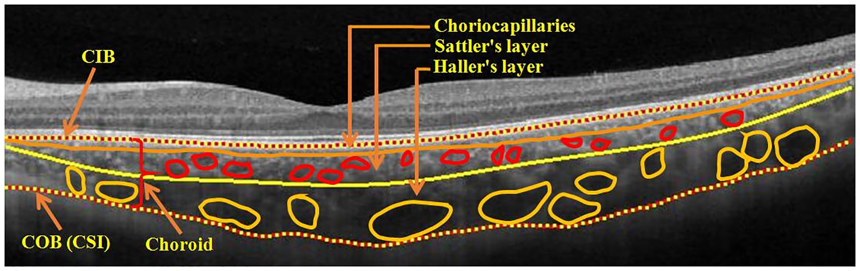 眼科専門医試験勉強ノート｜眼科医ぐちょぽいのオンライン勉強会
